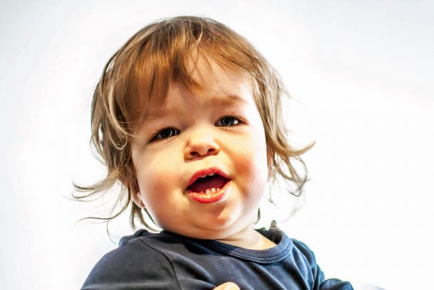 Achondroplasia | Causes, Signs, Standard Therapies, Prevention in ...