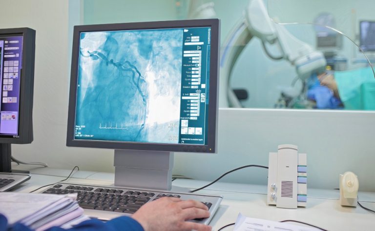 Peripheral Vascular Disease (PVD) | Causes, Symptoms, Diagnosis ...