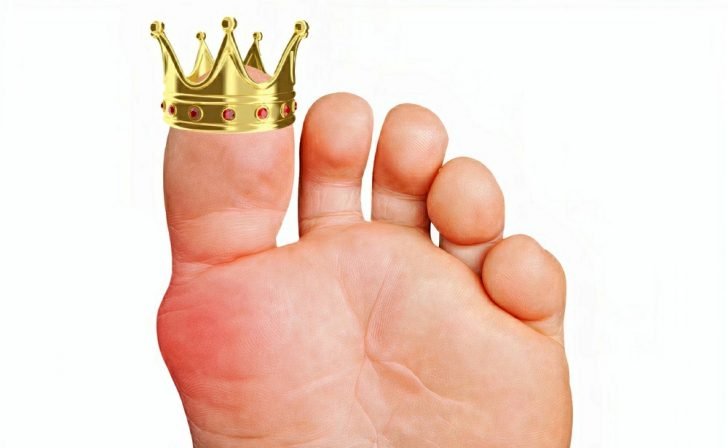 Gout | Causes, Clinical features, Diagnosis & Treatment - Left Side Pains