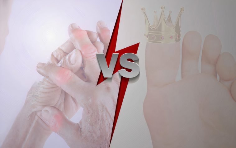 Rheumatoid Arthritis (RA) | All You Need to Know About Rheumatoid ...