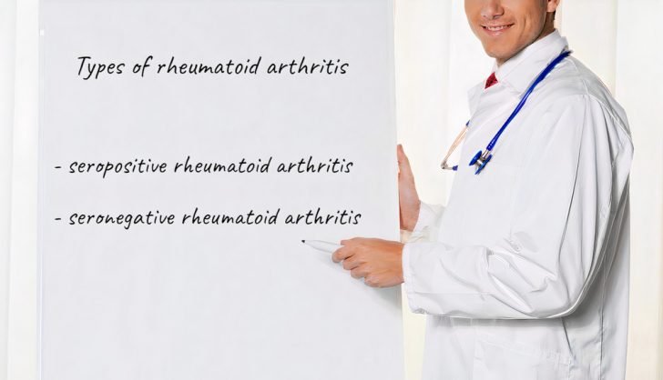 Rheumatoid Arthritis (RA) | All You Need to Know About Rheumatoid ...