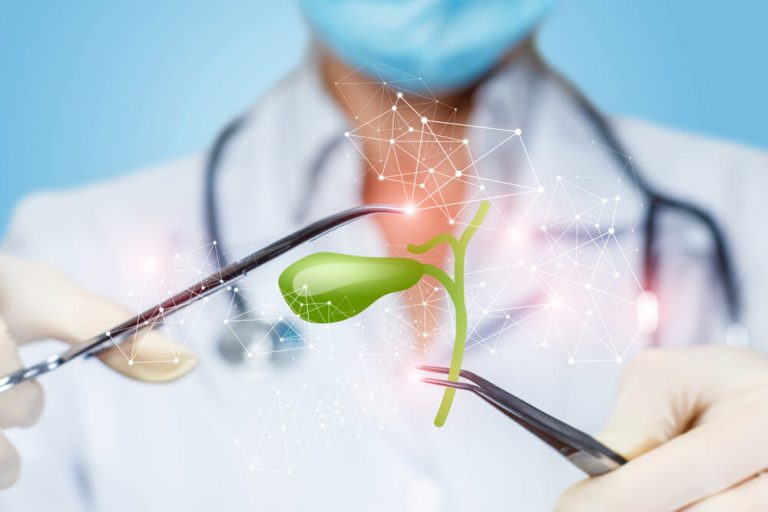 Cholecystectomy | All You Need to Know About Gallbladder Removal - Left ...