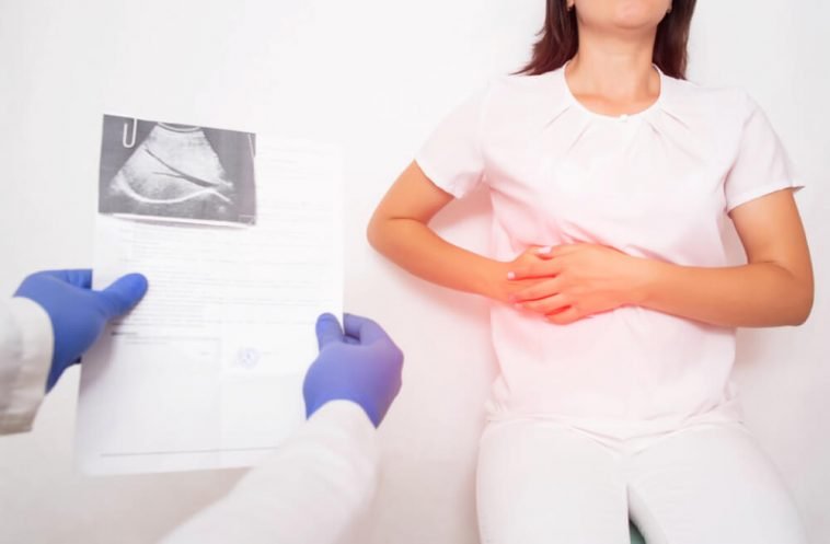 Cholecystectomy | All You Need to Know About Gallbladder Removal - Page ...