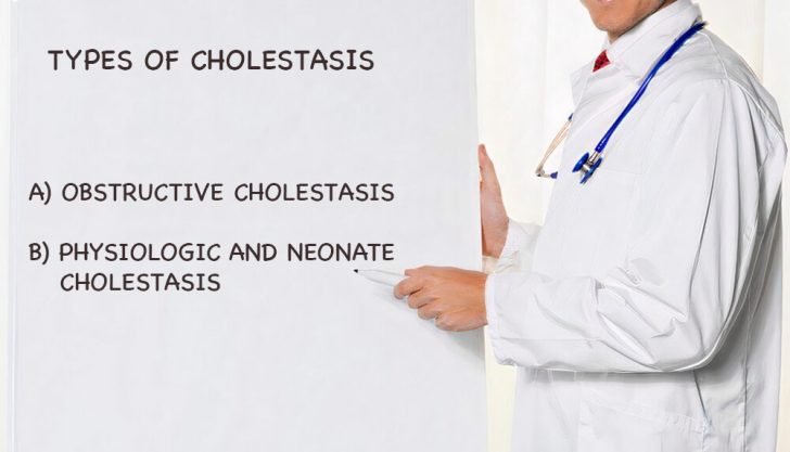 Cholestasis | Symptoms, Types, Diagnosis & Treatment - Page 6 of 13 ...