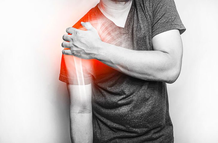 Shoulder Arthritis | Types, Causes, Symptoms, Diagnosis & Treatment of ...